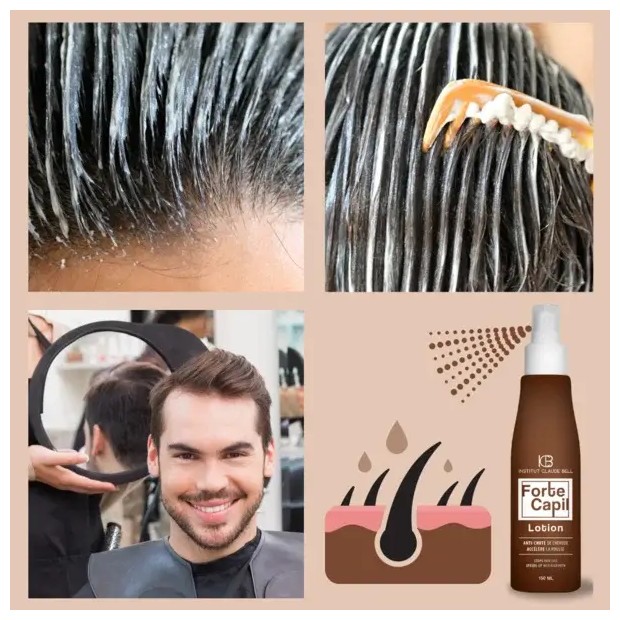 FORTE CAPIL șampon, balsam și loțiune - tratament împotriva căderii părului